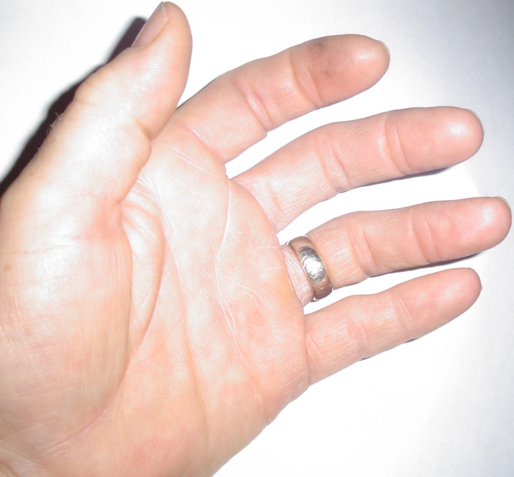 Empty Fingers. | HubPages