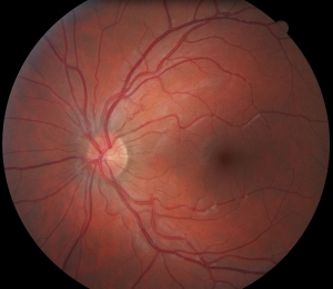 Your Eyes Can Reveal How Healthy You Are | HubPages